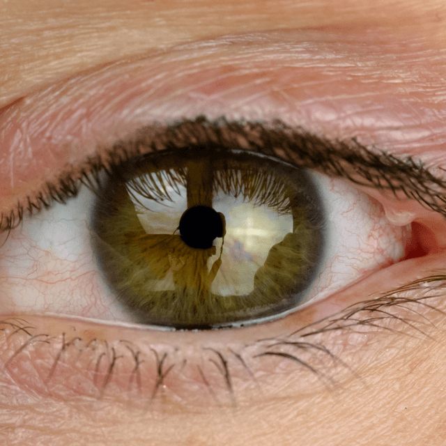 A Unique and Effective Treatment for Styes | Benjamin Eye Institute