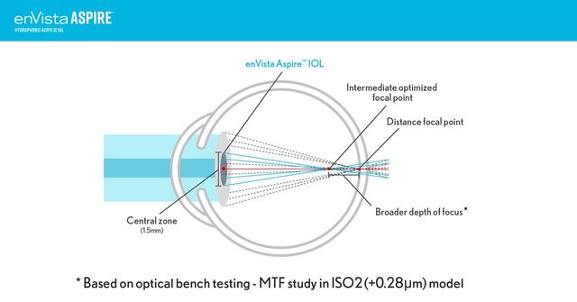 Introducing the Bausch and Lomb Aspire IOL: A New Standard in Vision ...